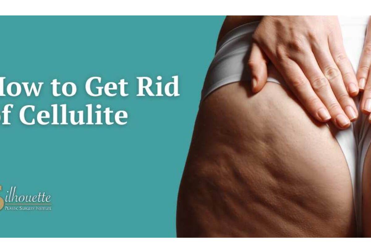 Cellulite – Essential Workouts To Eliminate Completely